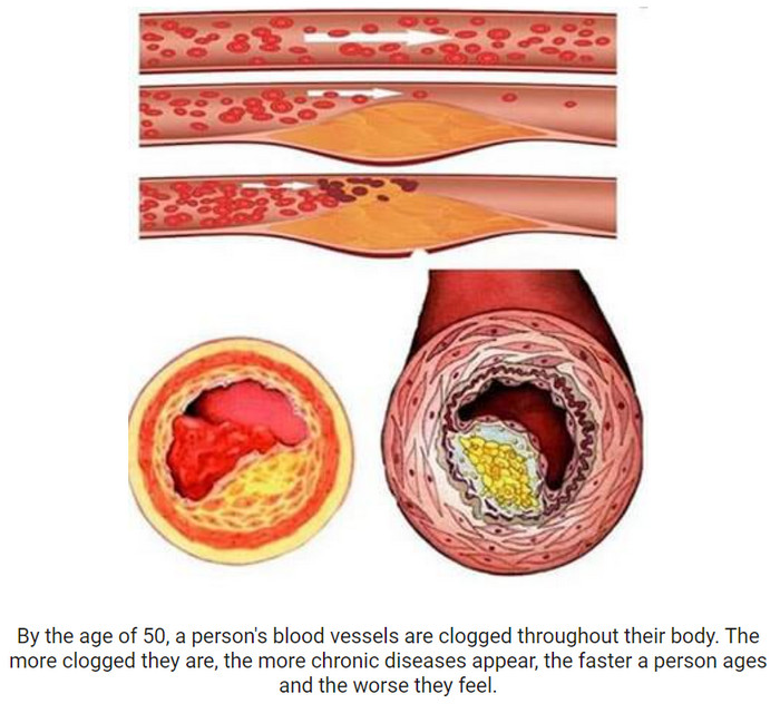 HyperGuard South Africa, how to use, reviews, price – control blood ...